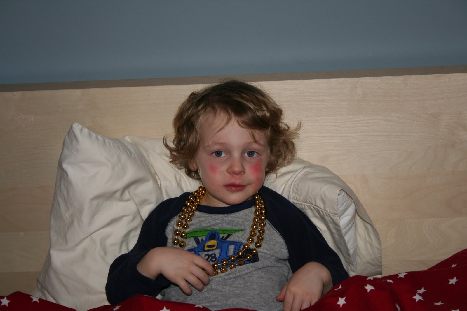 zman and gparker: Classic Parvovirus B19 Infection - otherwise known as ...