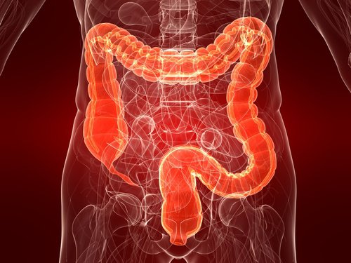 *Colitis Ulcerosa: Causas, *Síntomas y *Tratamiento | Salud Y Sucesos