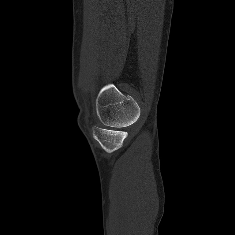 CT Knee - Radiology Imaging