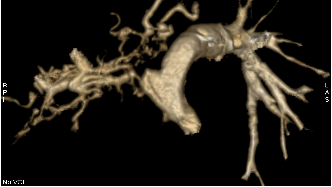 HealthforHeart: October 2014