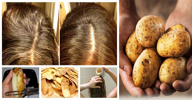 POTATO PEELS FOR GRAY HAIR – NO MORE HARSH CHEMICALS FOR YOUR HAIR - My ...