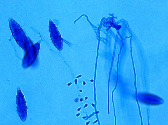 Fun With Microbiology (What's Buggin' You?): Microsporum gypseum