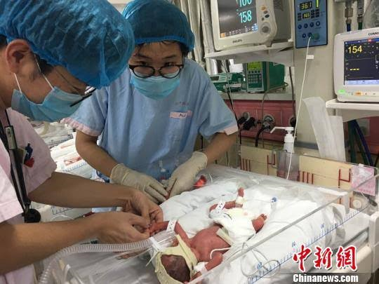 Photos: Woman gives birth to identical quadruplets