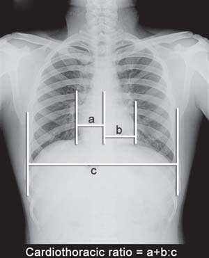 Study Medical Photos: Simplified Approach To Reading Chest X- Rays.