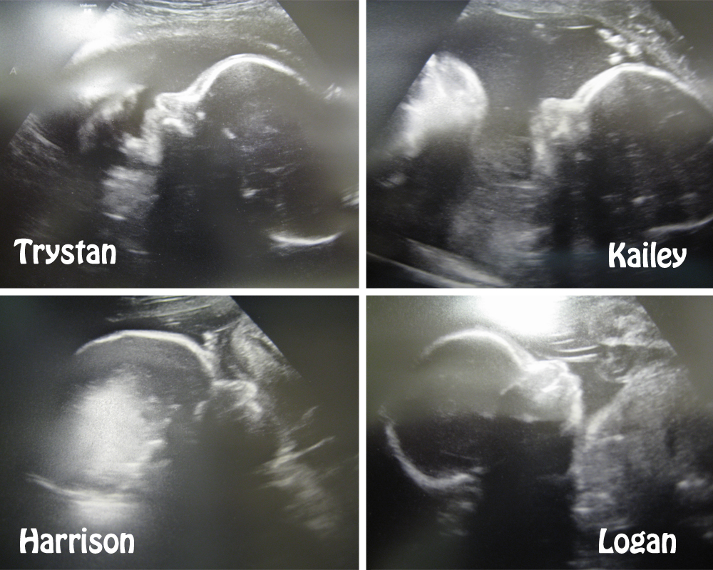 Texas Tales: {Quad Squad} Triplets, Quads, Oh My!