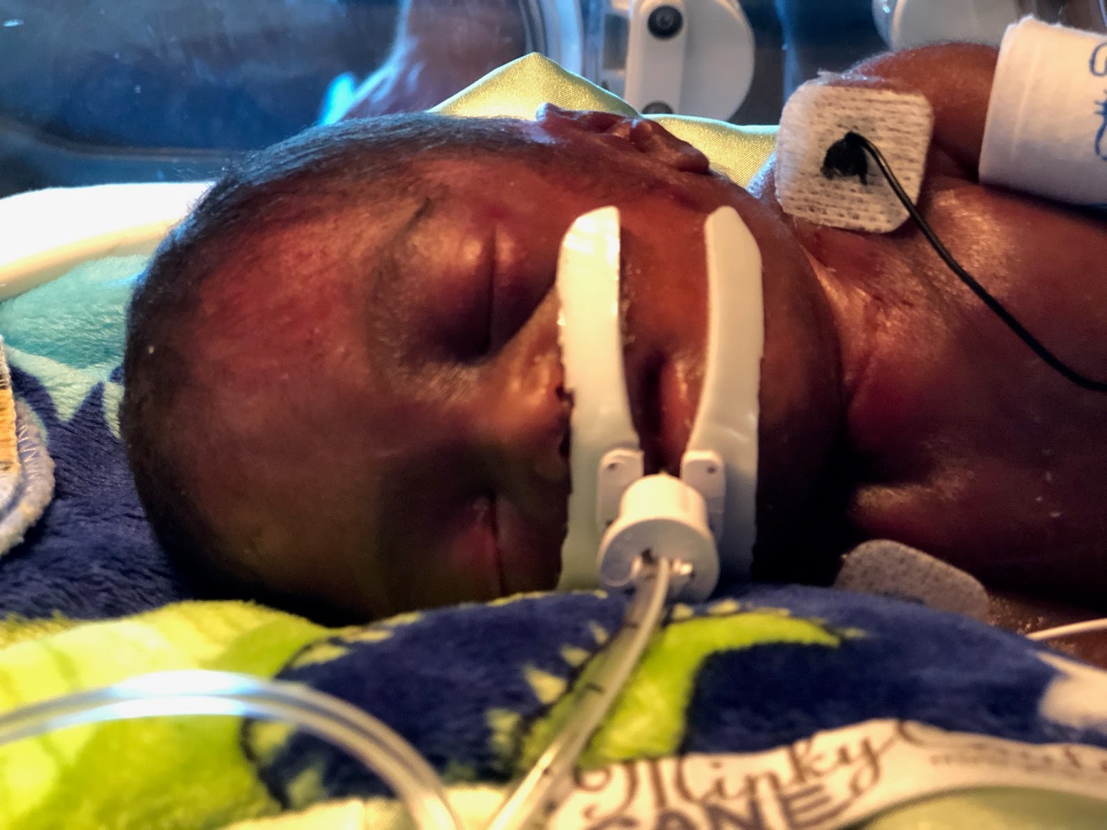 Our Big Crazy Family: Eights Days for Baby Cane