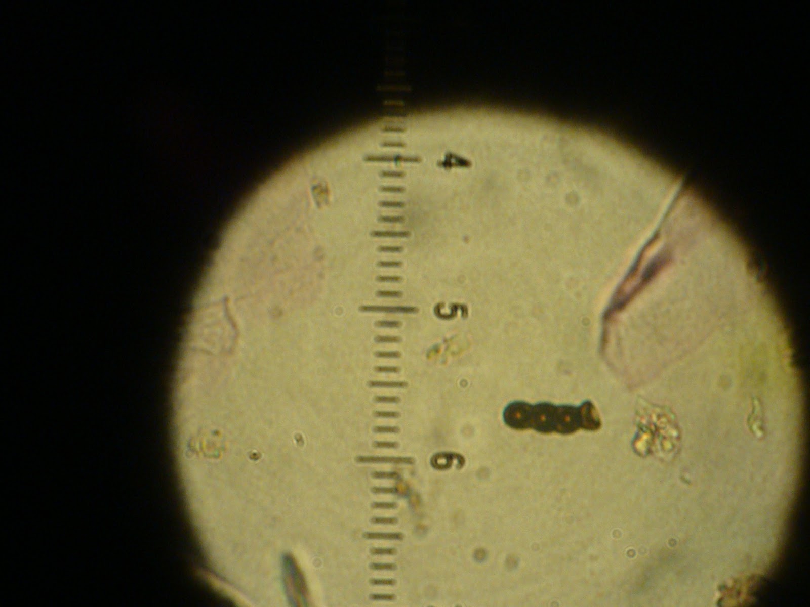 Sustainable Mycology: Torula spp.