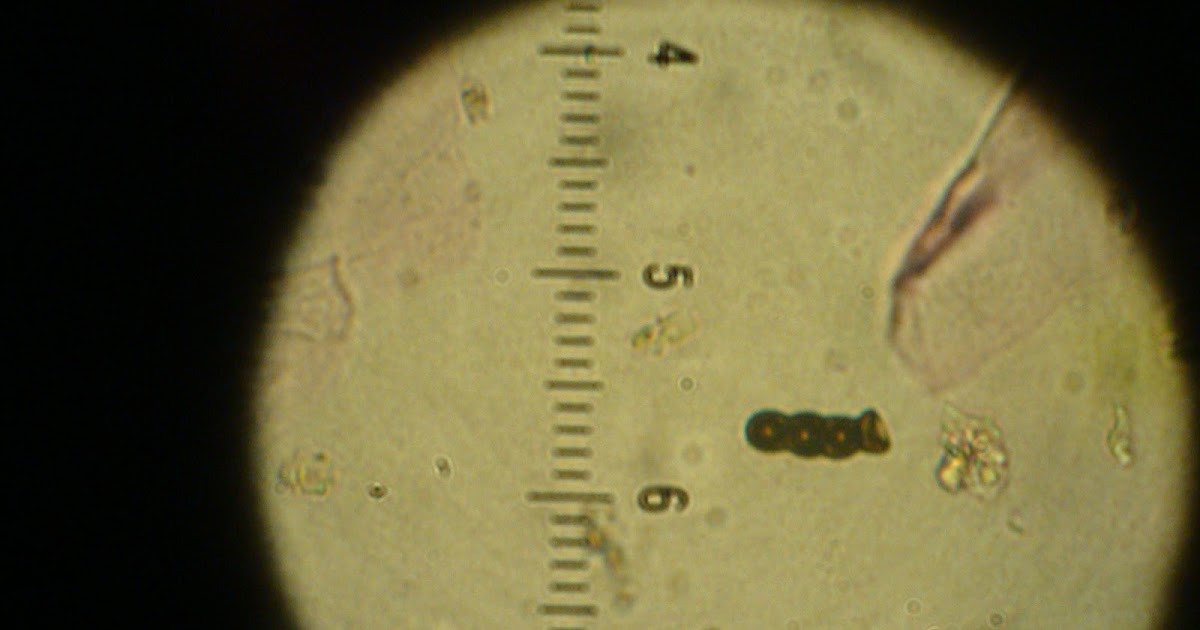 Sustainable Mycology: Torula spp.