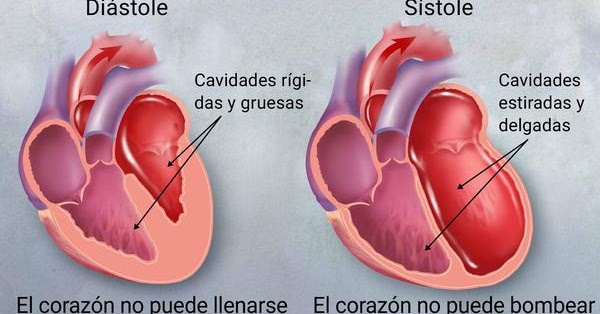 Klip7 Salud: informacion y tratamientos: ‘Entresto’, el nuevo ...