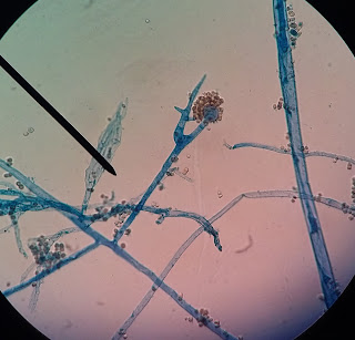 Rincón de Micología: Syncephlastrum sp.