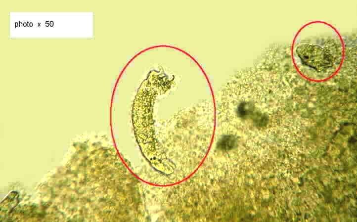 balebete baunajuku: Penyakit Cacing Kulit pada Ikan