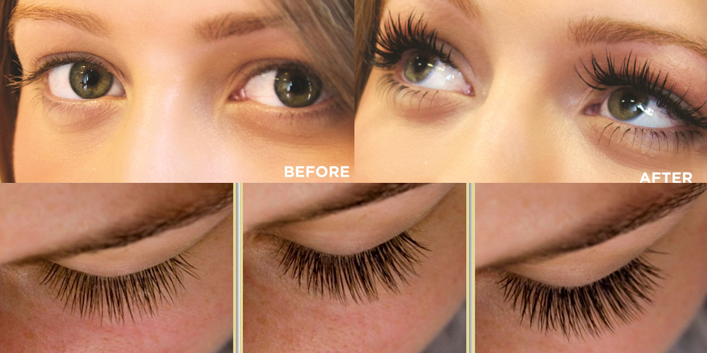 How to Get Your Eyebrows and Eyelashes Back Naturally Faster | Life ...