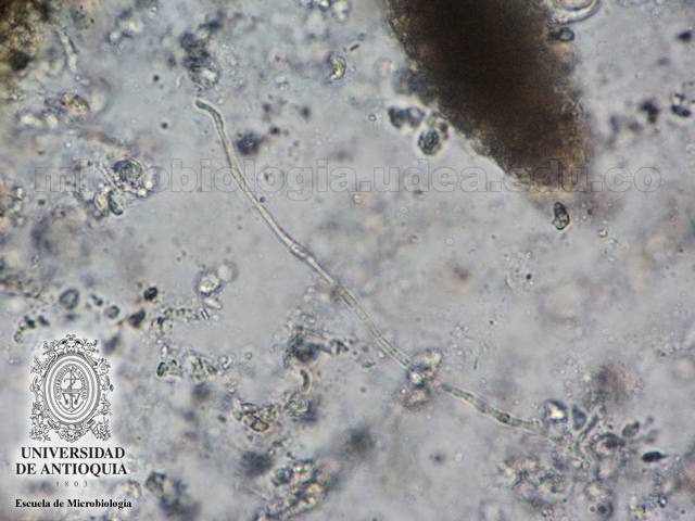 Enfermedad por hongo.: diciembre 2016