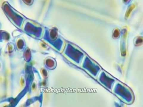 CIÊNCIAS DO AMBIENTE HUMANO: DERMATOFITOSES - TINEA PEDIS