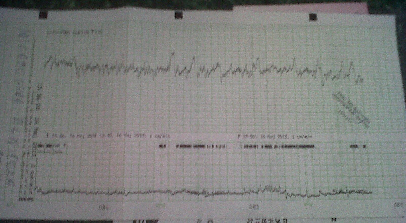 WilanFamily: 37 tydzień i zaczynamy KTG
