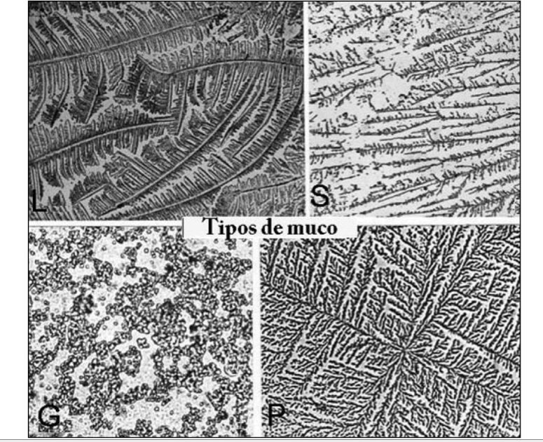 Fertilidade Inteligente: Microscopia dos diferentes tipos de muco
