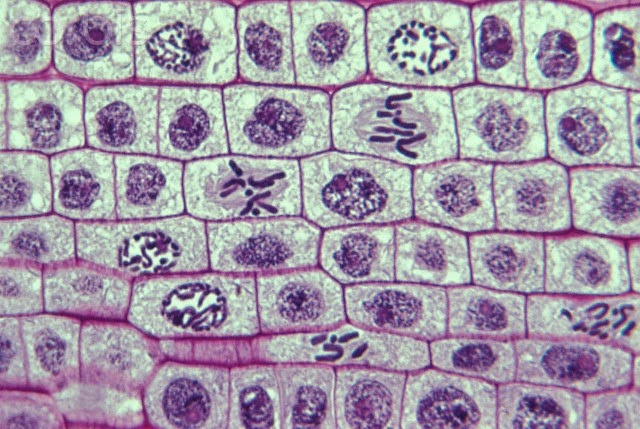Rudianto: Soal Pembelahan Mitosis