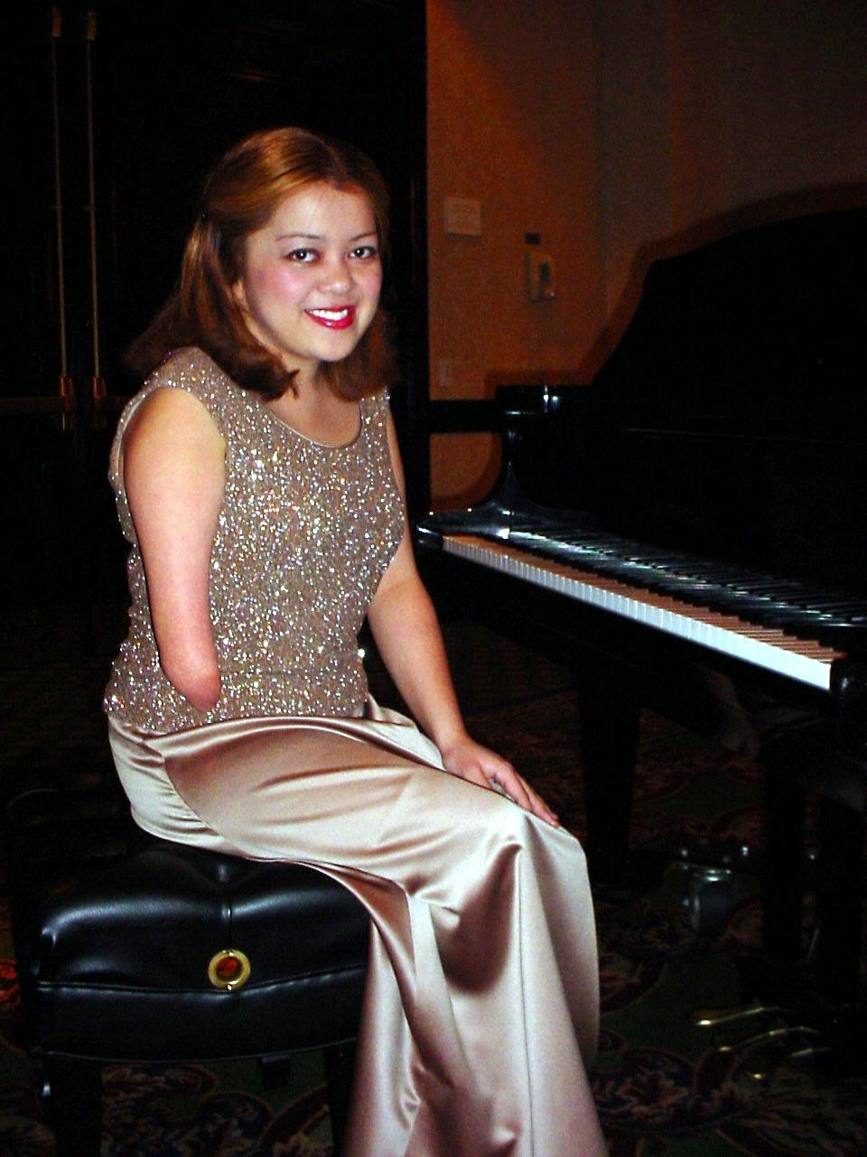 French Vocabulary Illustrated: moignon