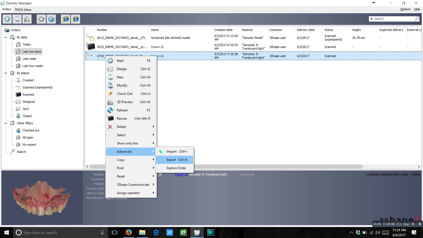 How you can convert Trios and Desktop scanner dcm files into stl with ...