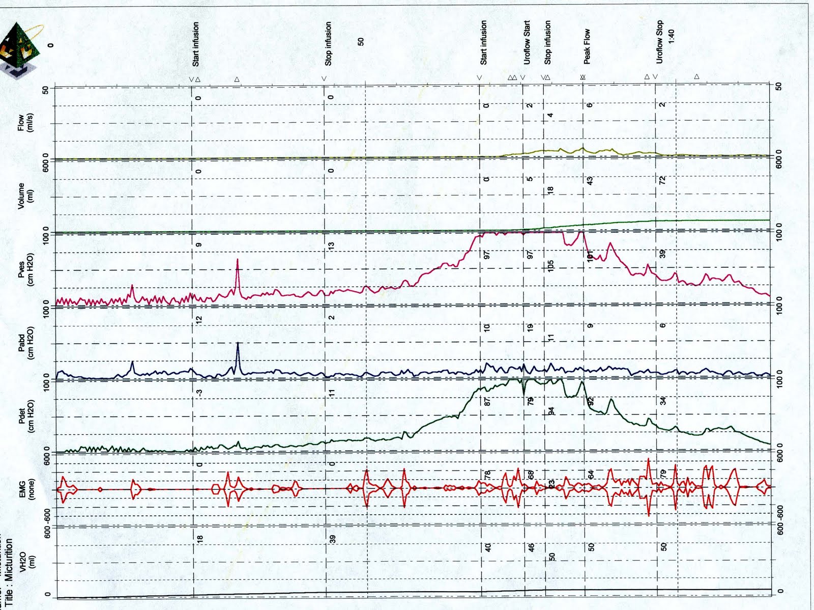 La utilidad de la urodinamia