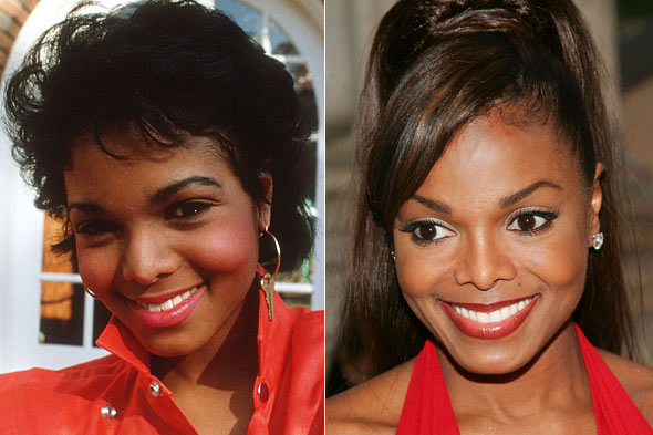 Janet Jackson Plastic Surgery