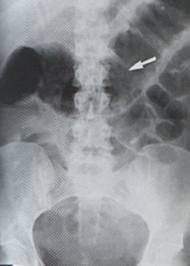 MEGACOLON ~ CimPUK2000 Galery