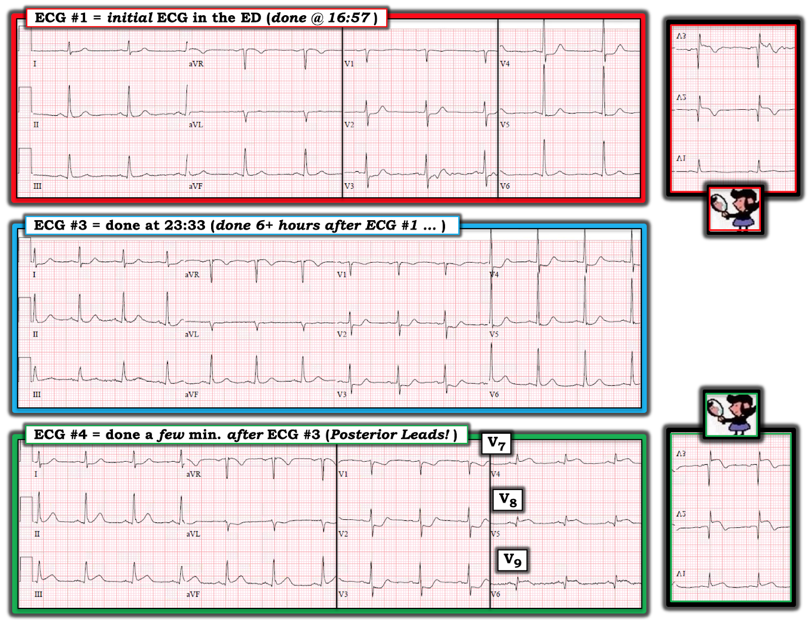 Dr. Smith's ECG Blog: February 2019
