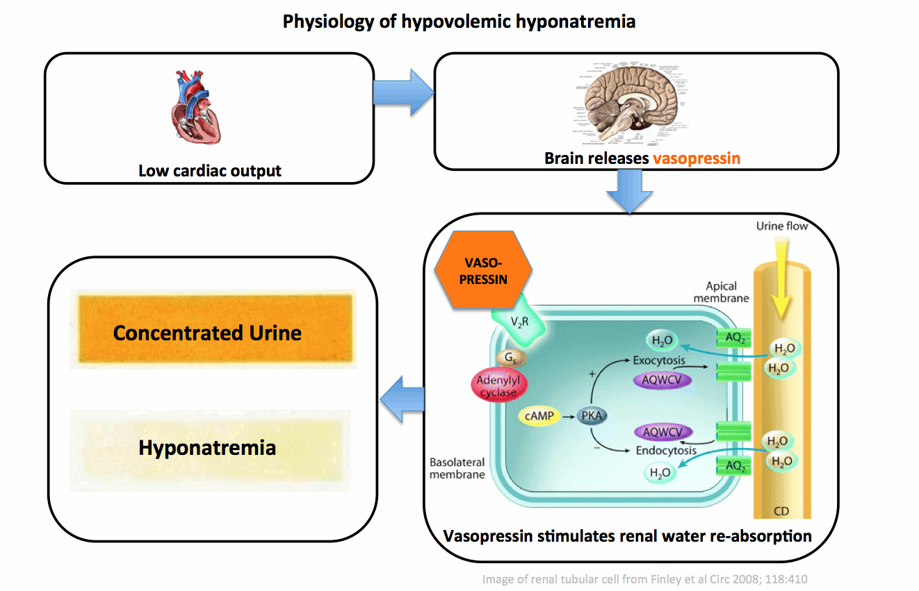 Taking control of severe hyponatremia with DDAVP