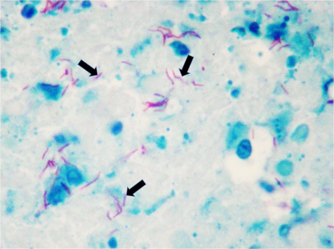 Microbiology Concepts: Acid Fast Staining (ZN Stain) & Other Microscopy ...
