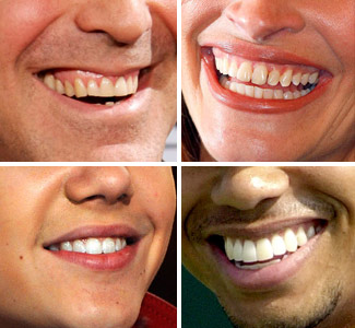Top Famous Smiles - Pix Magazine