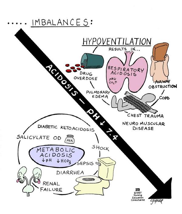 narsingPH: Causes of Acid-Base Imbalances