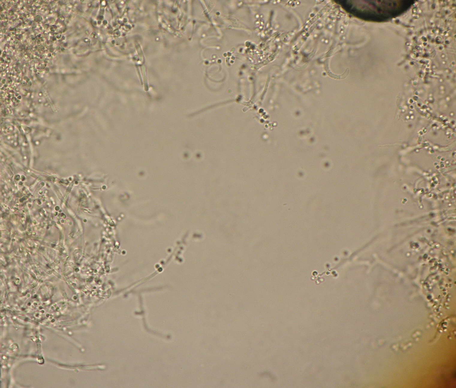 ATLAS MICOLOGIA: TRICHOPHYTON MENTAGROPHYTES