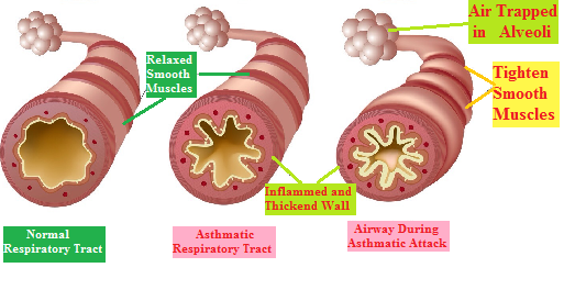 pharmacology: Asthma Bronchodilator