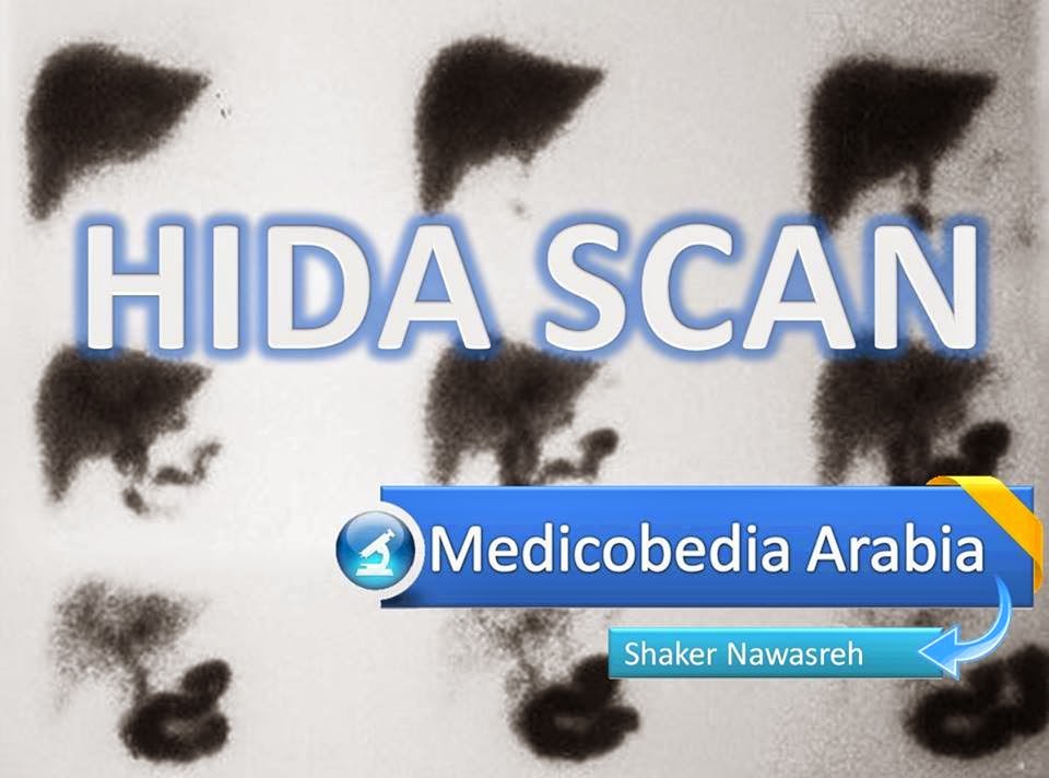 Medicopediaarabia: HIDA SCAN