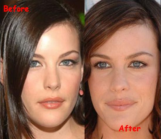 trendystyle: Megan Fox plastic surgery before after, Megan Fox plastic ...