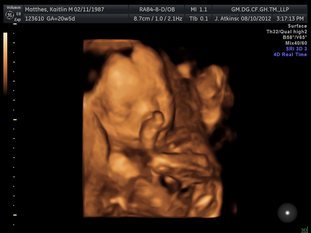 Lovin' On Littles: 21 Week Ultrasound