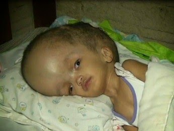 14 Most Bizarre Medical Conditions on Earth - CityRovers.net || News as ...