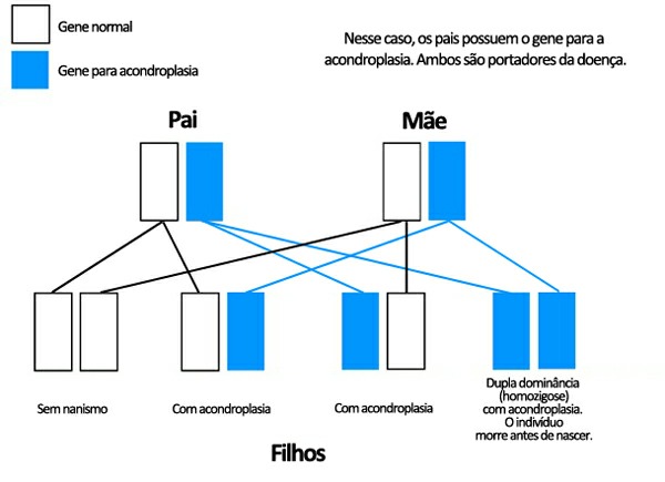 Você sabe o que é Acondroplasia? | Nó Górdio