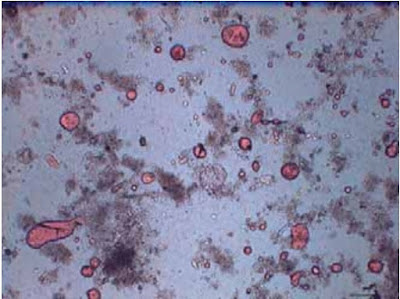 [Microbiology] Atlas of Fecal Analysis | Free Medical Atlas