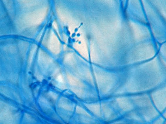 Fun With Microbiology (What's Buggin' You?): Beauveria species