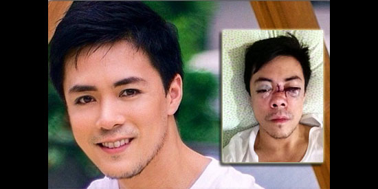 swordshines10: bago lumitaw si XANDER FORD, may isang LANCE RAYMUNDO ...