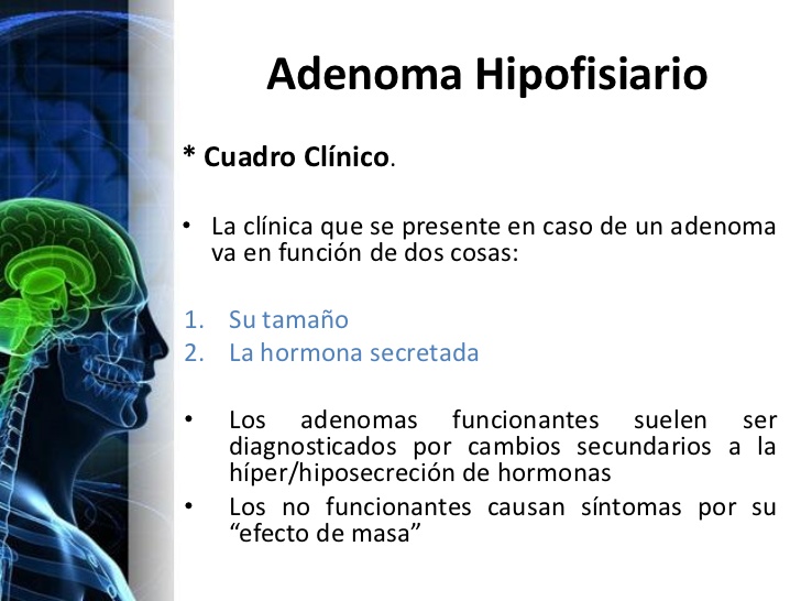 Endocrinología Managua: Adenoma de hipófisis o tumor pituitario