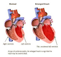 Decreased Cardiac Output related to CHF - Nursing Notes