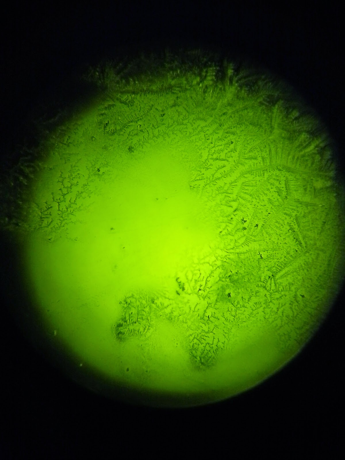 TTC with Saliva Microscope: Day by day ferning - Maybe Baby Saliva ...