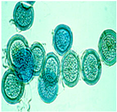 Parasitologi Kelompok 2 | WE LOVE 1A2