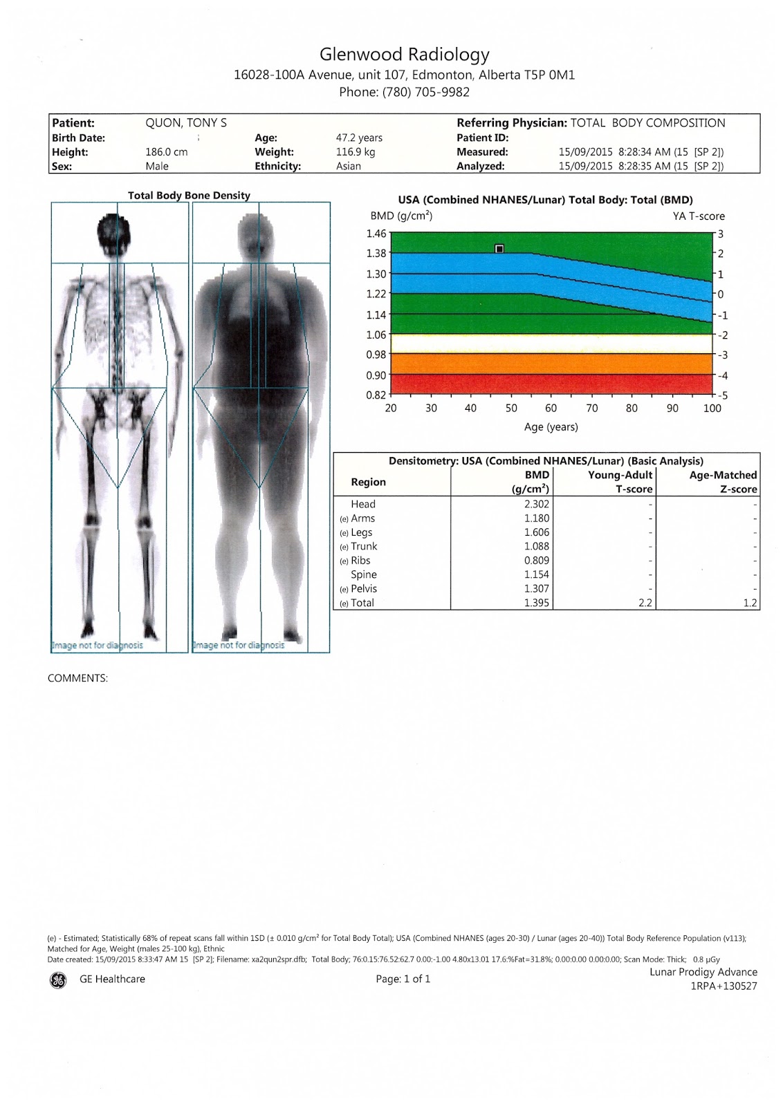 DXA Scan: Body Composition; my experience and what I am I going to do next!
