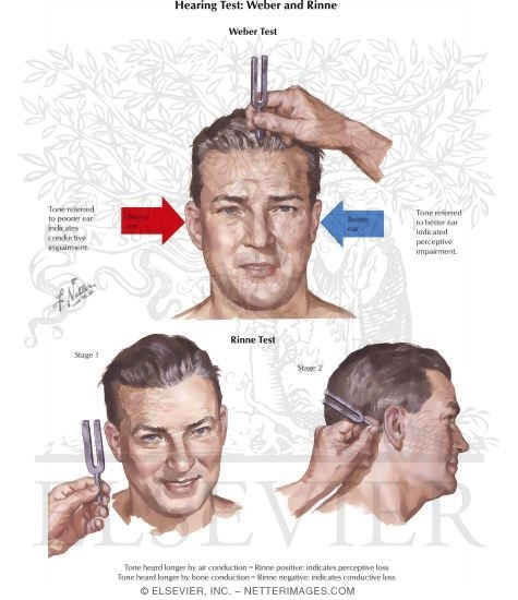 PUTRA'S BLOG: Praktikum Psikologi Faal : Tes Weber