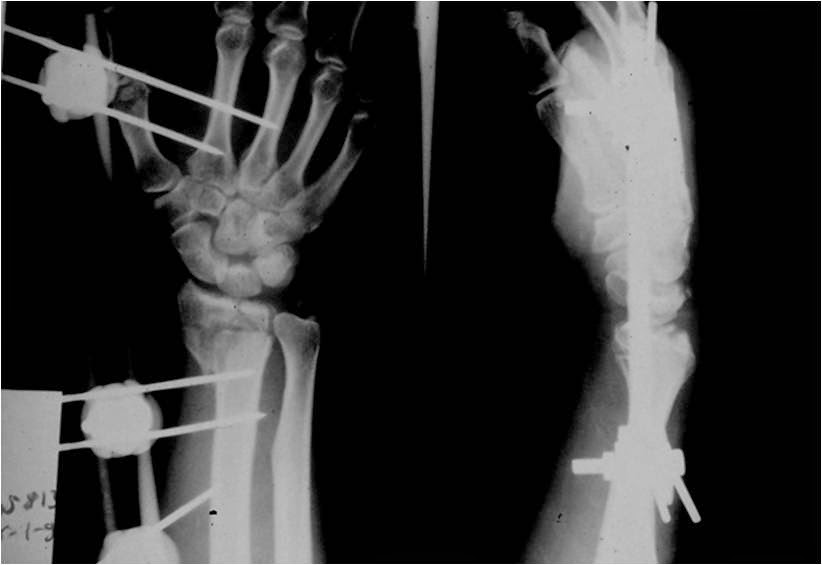 FERN Usosy aplicaciones: 13.b.- Aplicaciones