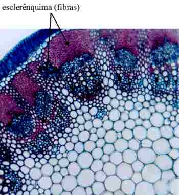 Tecidos - Histologia Vegetal: ESCLERÊNQUIMA