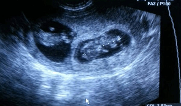 Mitos Hamil Anggur Dan Pengenalannya